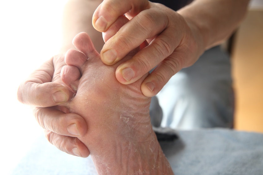 Soins Des Pieds Ordre Des Podiatres Du Québec